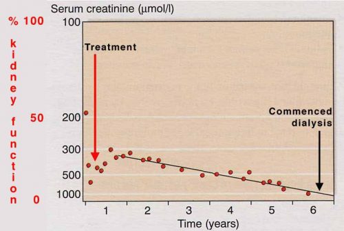 Chronic renal failure and its progression (CKD) – edren.org